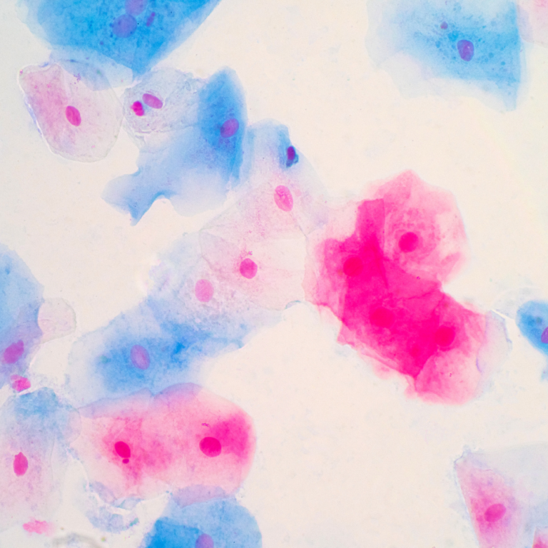 Women's health, molecular analyzer and liquid-based pap test - Gatineau ...